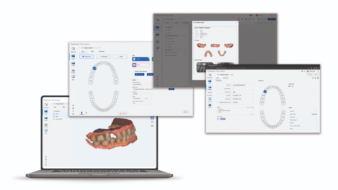 MyScan WL: Precision and Reliability | MyRay