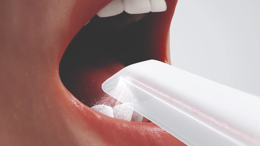 MyScan WL: Precision and Reliability | MyRay