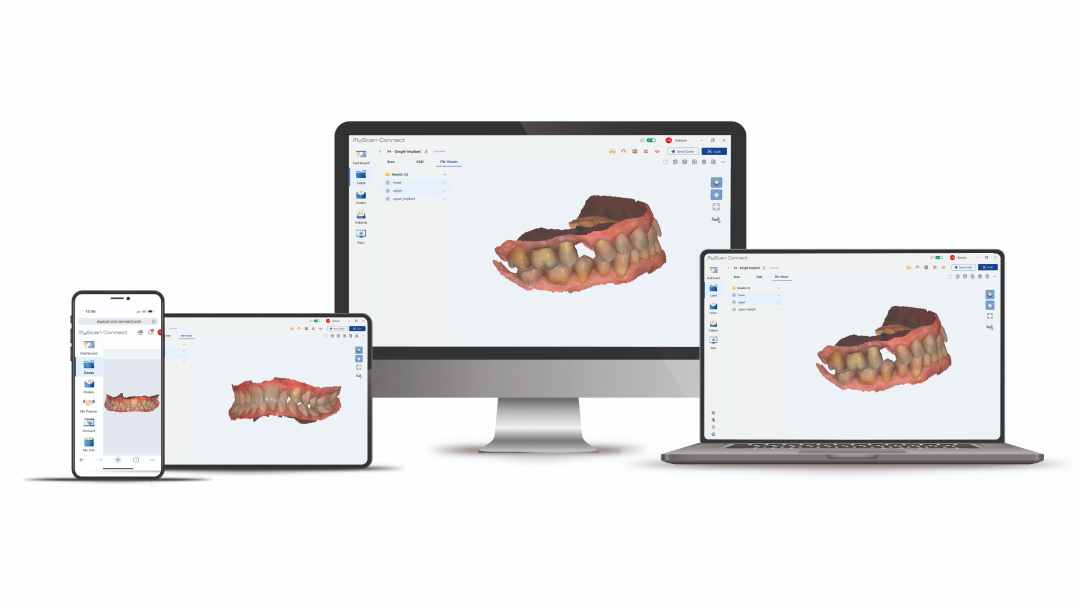 MyScan WL Wireless Intraoral Scanner | MyRay