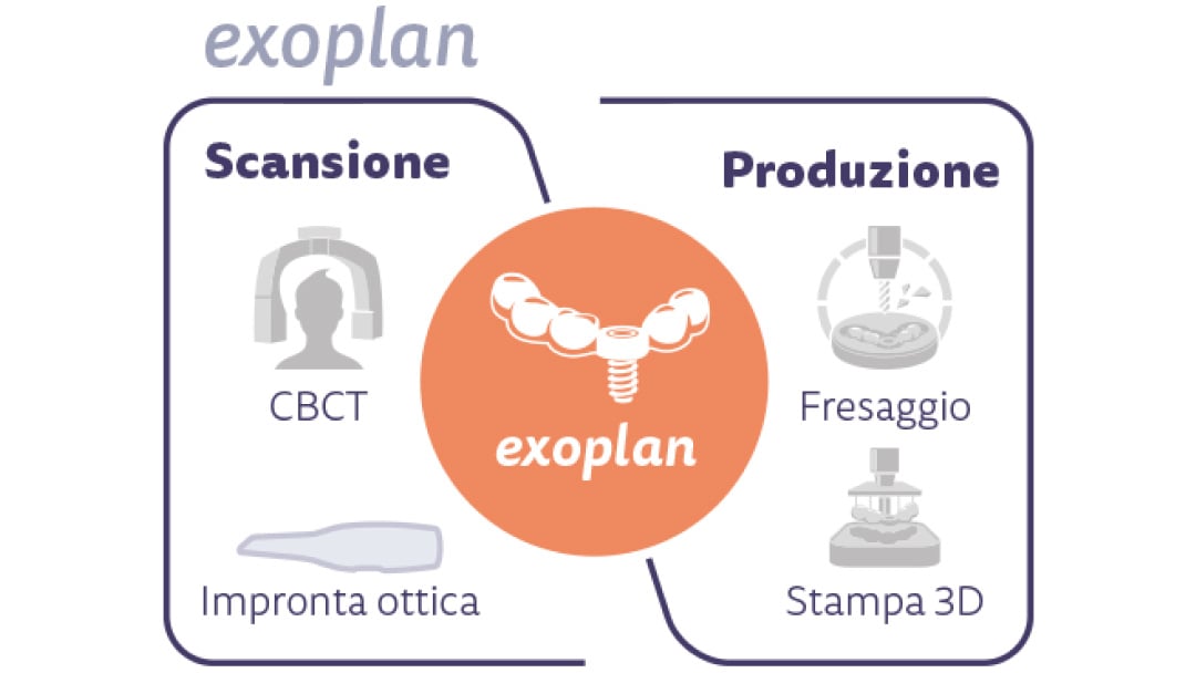 Software per Progettazione Impianti Dentali Exocad | MyRay