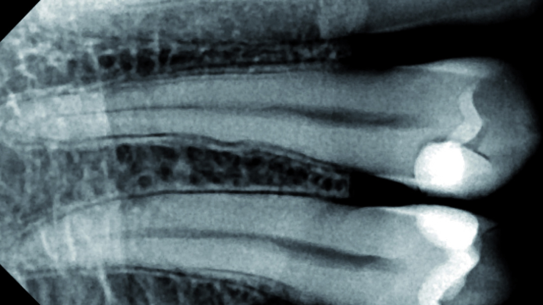 Radiographie Intraorale RXDC Hypersphere | MyRay