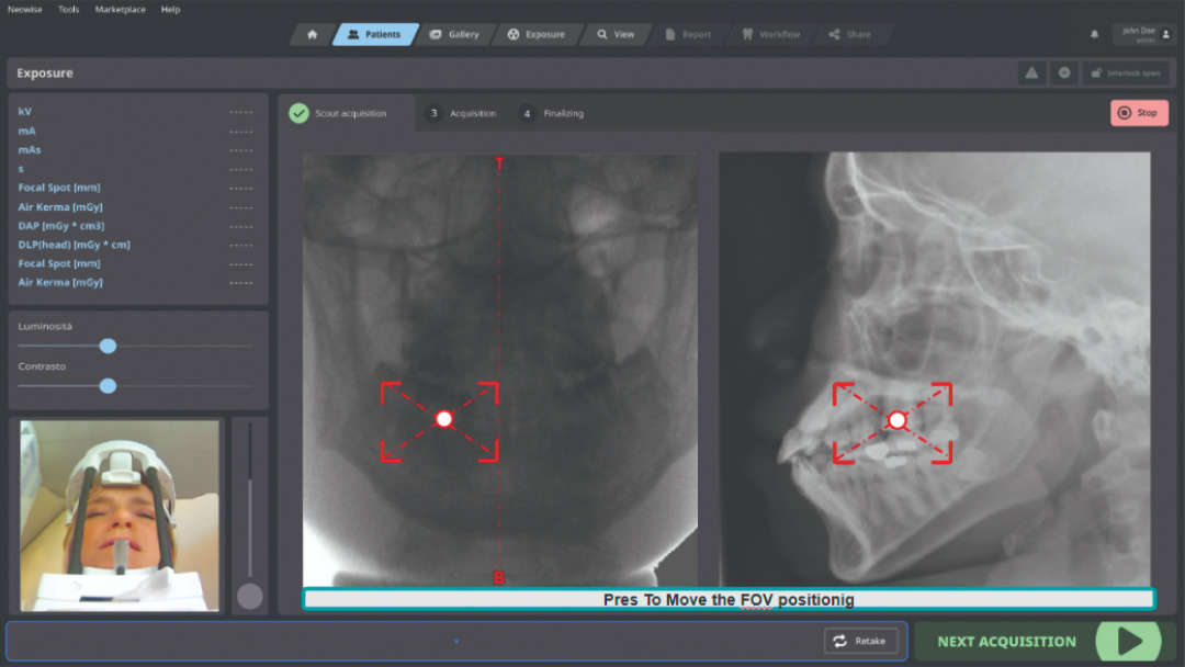 ProXIma X6: Radiological Excellence | MyRay