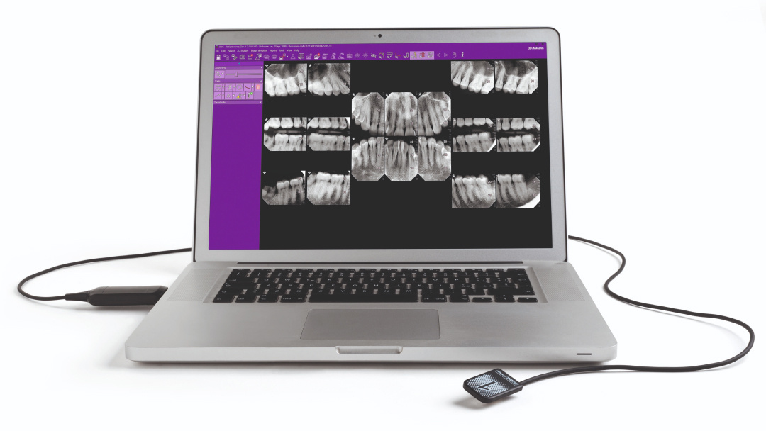 Zen-X E Intraoral Sensor for Real-time Images | MyRay
