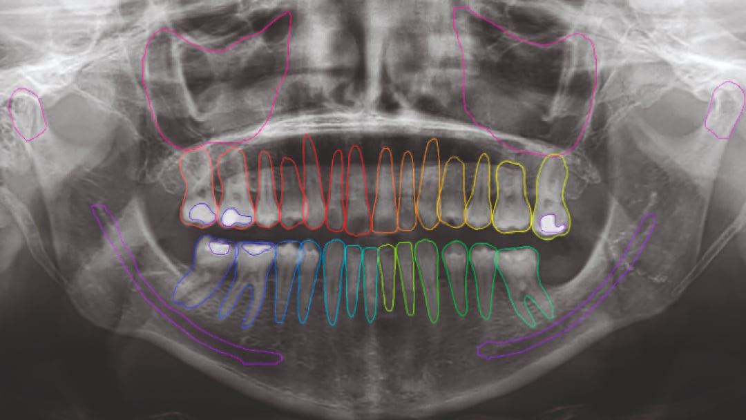 Neowise: Dental Imaging Software | MyRay
